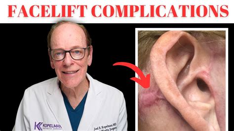 How To Manage Facelift Complications Plastic Surgeon Advice Youtube