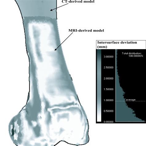 Local 2d Contour Based Measurement Of Matching Deviation In The Middle