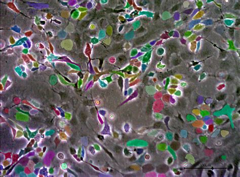 Cellpose Gui Accuracy Metric Concern Image Analysis Imagesc Forum