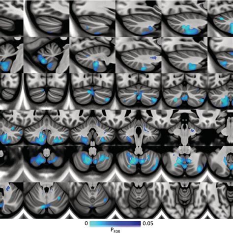 Voxel‐wise Texture Similarity Analysis Sagittal Top Two Rows Download Scientific Diagram