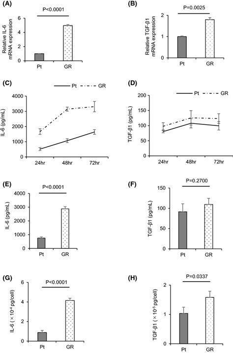 IL and TGF β expression in Pt versus GR biliary tract cancer cells Download Scientific