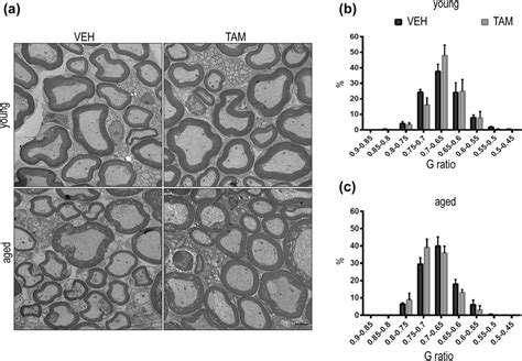 Sciatic Nerve Myelination Was Normal In Young And Aged Bace1 Cko Mice Download Scientific