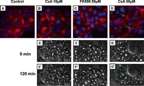 Alteration Of F Actin Cytoskeletal Distribution And Bile Canaliculi