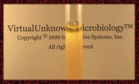 Of Glucose Test Virtual Microbiology Lab Simulator Software