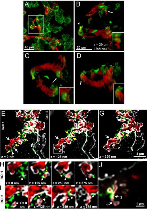 Macrophages Make Intricate F Actin Structures That Promotes Macrophage Download Scientific