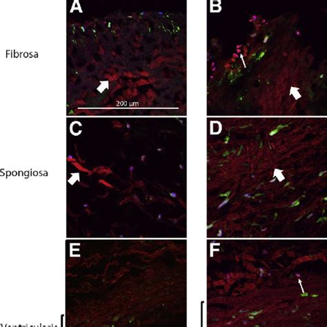 Second Harmonic Generation Microscopy Of Collagen Download Scientific