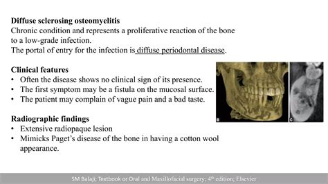 Osteomyelitis Of Jaw Pptx
