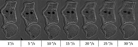 Target Frame Motion Artefacts Ct Target Images At Varying Angular Download Scientific Diagram