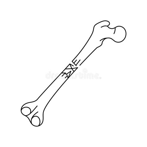 Communuted Bone Fracture Line Icon Stock Vector Illustration Of Break Cartilage 311401646