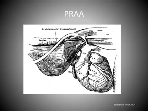 Ppt Persistent Right 4 Th Aortic Arch Powerpoint Presentation Free Download Id 4801645