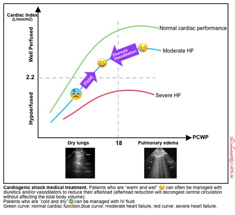 Cardiogenic Shock Recapem