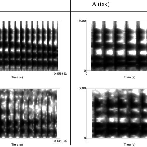 Portuguese Vowel And Their Acoustic Space Linear Scale Vowels Of