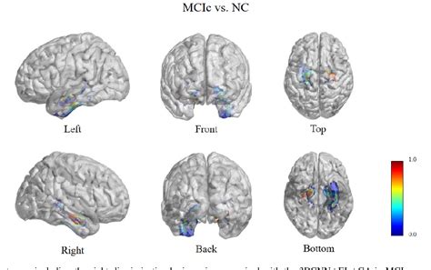 Figure 9 From Adaptive 3dcnn Based Interpretable Ensemble Model For Early Diagnosis Of Alzheimer