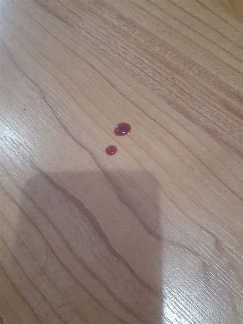 Female Cat Bleeding From Anus Thecatsite
