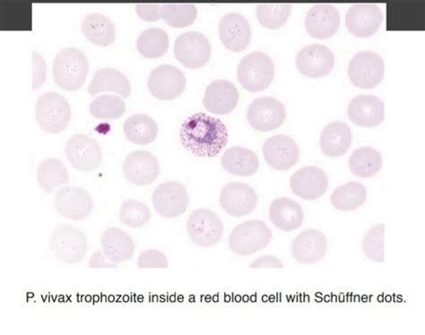 Malaria Flashcards Quizlet