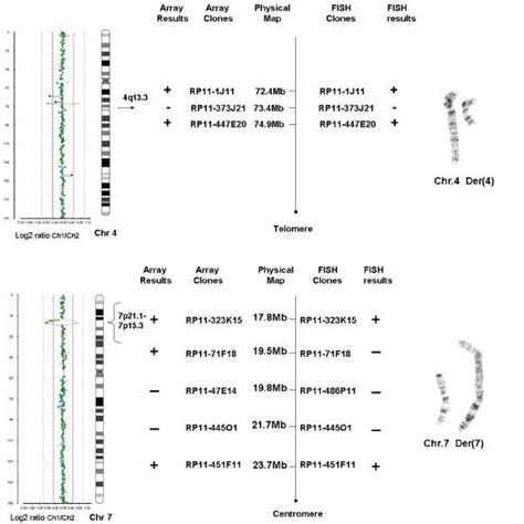 Array Cgh Results Of Case 2 For Chromosome 7 And Schematic Comparison Download Scientific