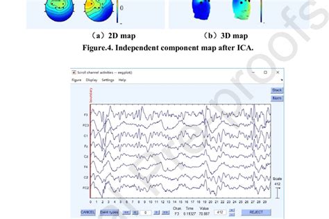 The Eeg Signal After Pre Processing Download Scientific Diagram