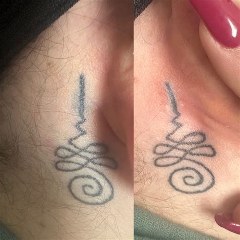 Tattoo Blowout Causes And Solutions Explained Bush Whacked Laser
