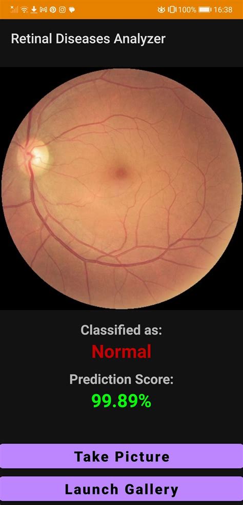 Github Jackaquamin4 Classes Retinal Diseases Classification