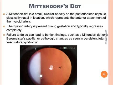 Dots Spots Lines And Rings In Ophthalmology Pptx