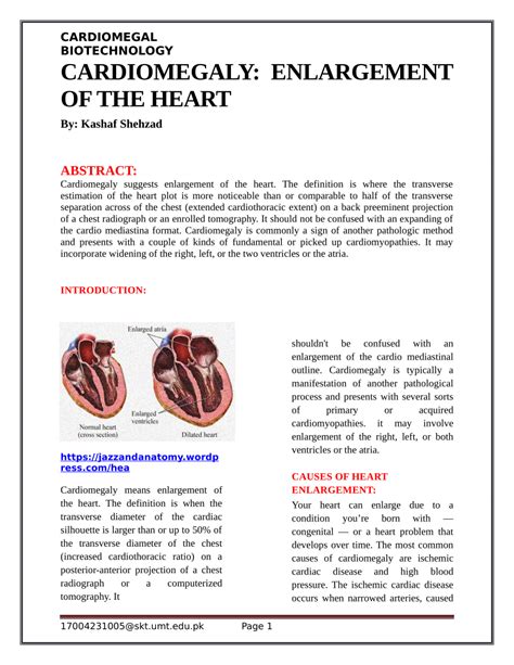 Cardiomegaly Causes Cardiomegaly Enlarged Heart Symptoms