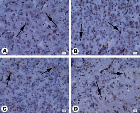Cross Sections Of A Granular Layer In The Cerebral Cortex By PCNA Download Scientific Diagram