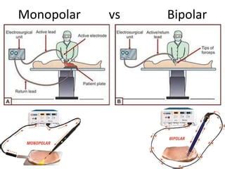Diathermy In Surgery Pptx