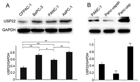 Usp22 Promotes Epithelial Mesenchymal Transition Via The Fak Pathway In
