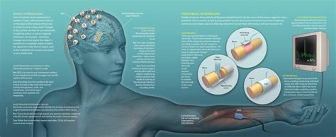 Neuroprosthetics Brain Interface Applied In Neurology Nanalyze
