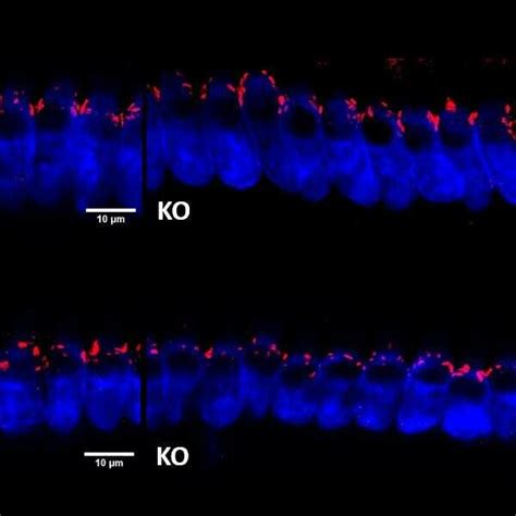 Quantitative Analysis Of Synaptic Ribbons In Cochlear Inner Hair Cells Download Scientific