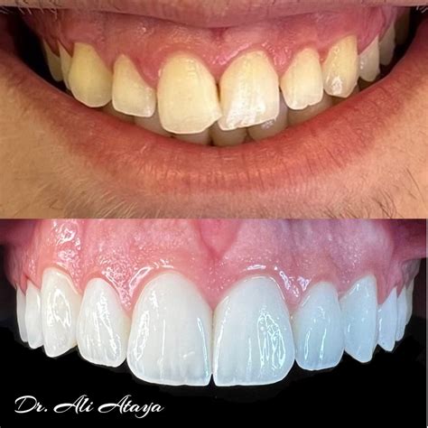 Ali Ataya Posted On Linkedin