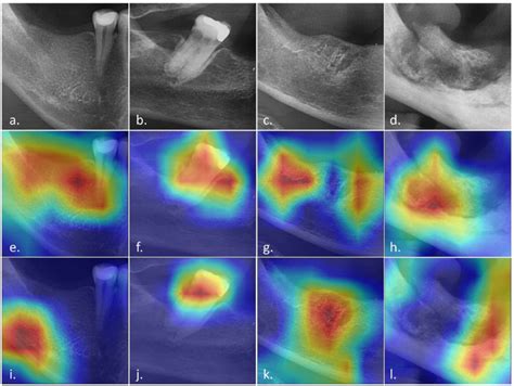 Gradient Weighted Class Activation Mapping Grad Cam Of The Download Scientific Diagram
