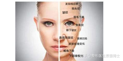 皱纹太显老抬头纹鱼尾纹法令纹3分钟告诉你如何改善 知乎