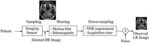 Overview Of Practical Mri Image Acquisition Model Source 4 Fig 2