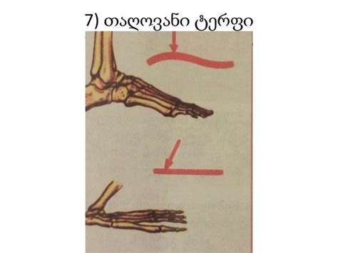 ჩონჩხი