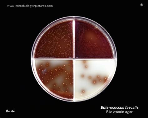 Enterococcus Faecium Vs Faecalis En Agar Sangre Pdf Phenotypic And
