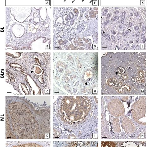 Radiological And Edx Data Of Breast Microcalcifications A Radiological Download Scientific