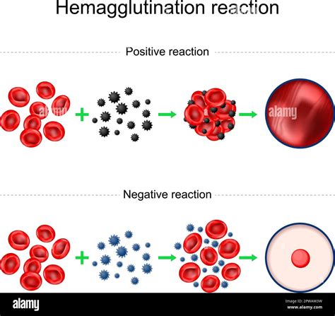 How To Perform Agglutination Test At Linwood Morales Blog