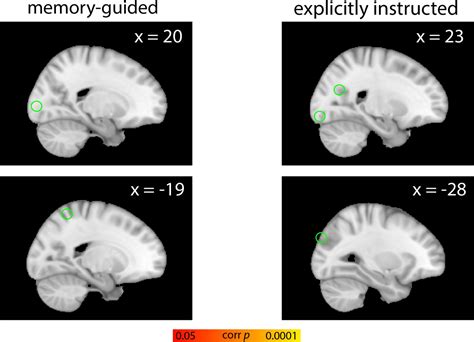 Figures And Data In Preparation For Upcoming Attentional States In The Hippocampus And Medial