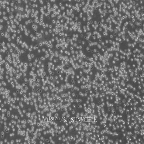 Sp2 0 Ag14细胞 小鼠骨髓瘤细胞 武汉尚恩生物技术有限公司