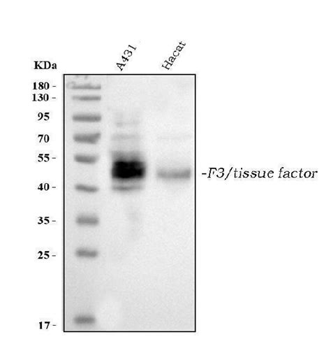 Tissue Factorf3 Antibody Pb9701