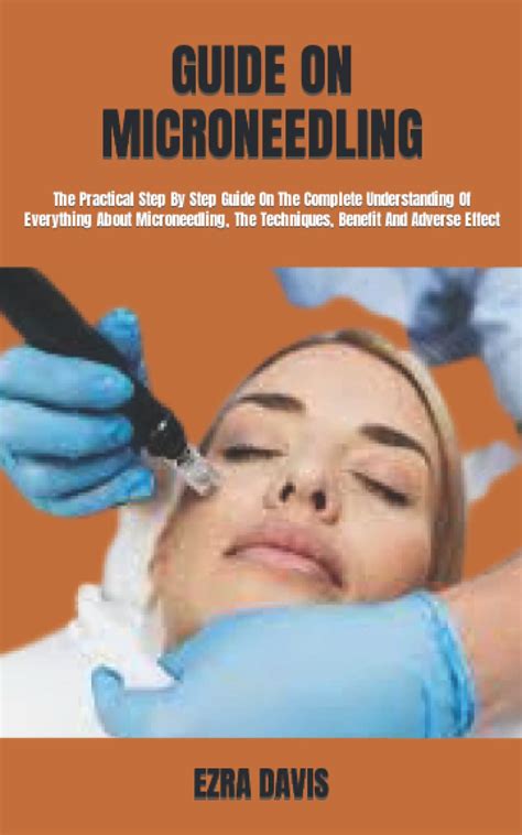 Buy Guide On Microneedling The Practical Step By Step Guide On The