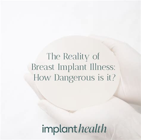 The Reality Of Breast Implant Illness How Dangerous Is It Breast