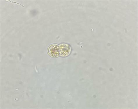 Would Anyone Help Me Identifying This Bug ResearchGate