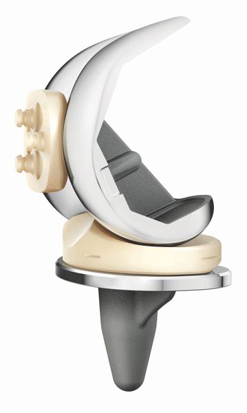 Attune Trumatch Product And X Ray Images Depuy Synthes