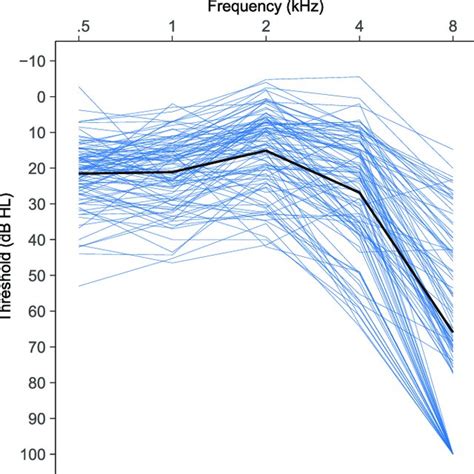E Pure Tone Audiometry Hearing Thresholds Db Hl For Frequencies From Download Scientific