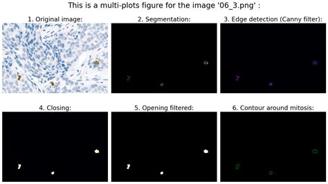 Automated Mitosis Detection And Analysis In Histological Images Using