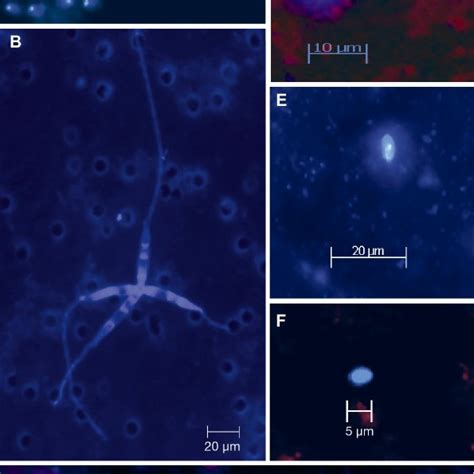 Observation Of Fungal Cells Using Calcofluor Dapi Staining And