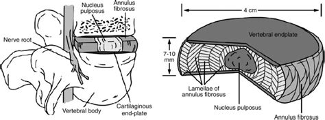 Intervertebral Disc Structure