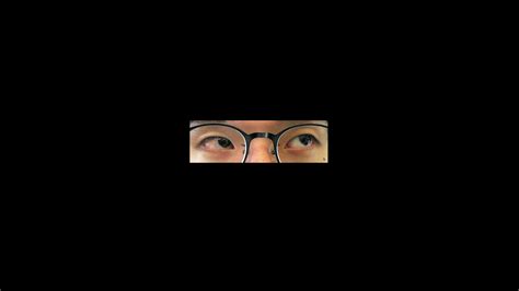 eye diseases detect 2 object detection dataset by muhammad risma